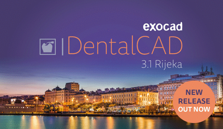 最新版 exocad 3.1 Rijeka | 7月1日より発売 | デンケン・ハイデンタル株式会社